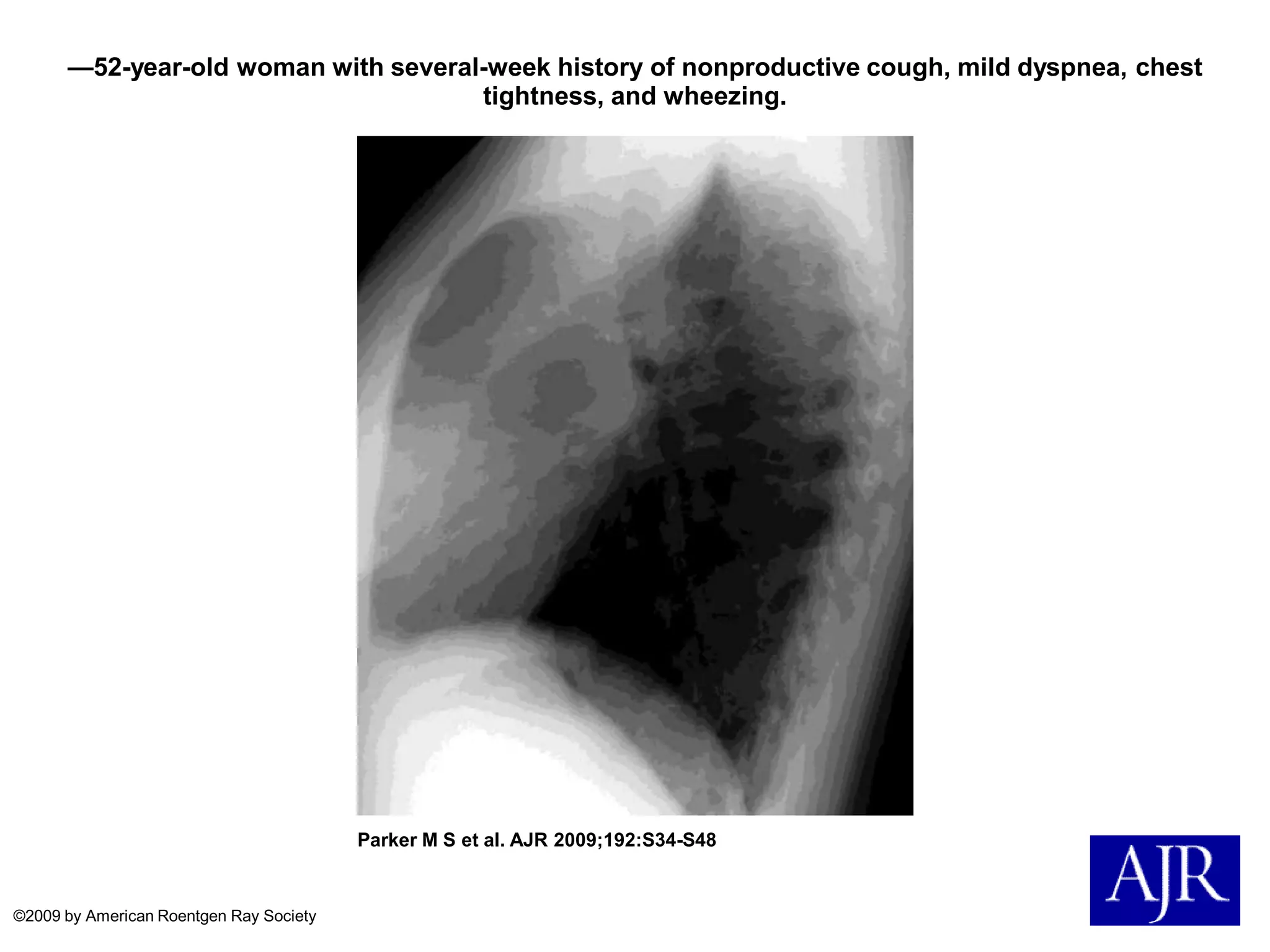Radiological signs in thoracic imaging ( AJR article) | PPTX