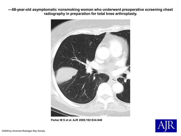 Radiological signs in thoracic imaging ( AJR article) | PPTX