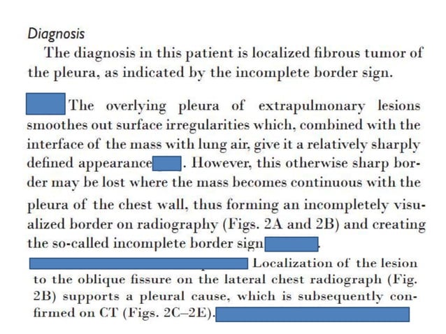 Radiological signs in thoracic imaging ( AJR article) | PPTX