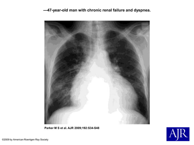 Radiological signs in thoracic imaging ( AJR article) | PPTX