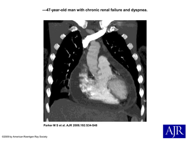 Radiological signs in thoracic imaging ( AJR article) | PPTX