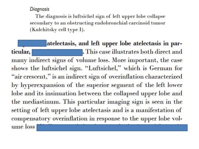 Radiological signs in thoracic imaging ( AJR article) | PPTX