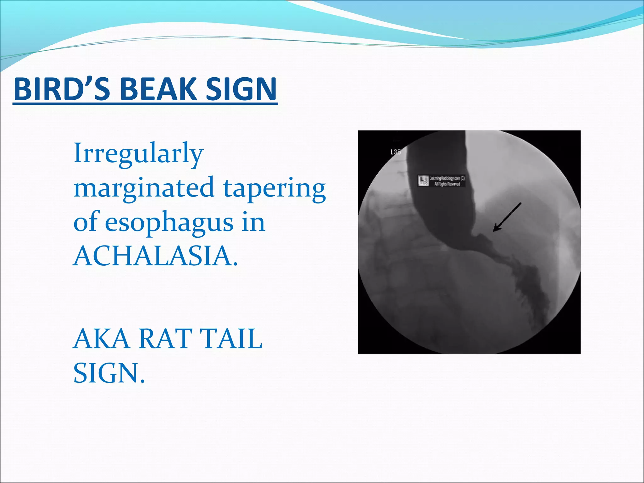 Radiology signs | PPT