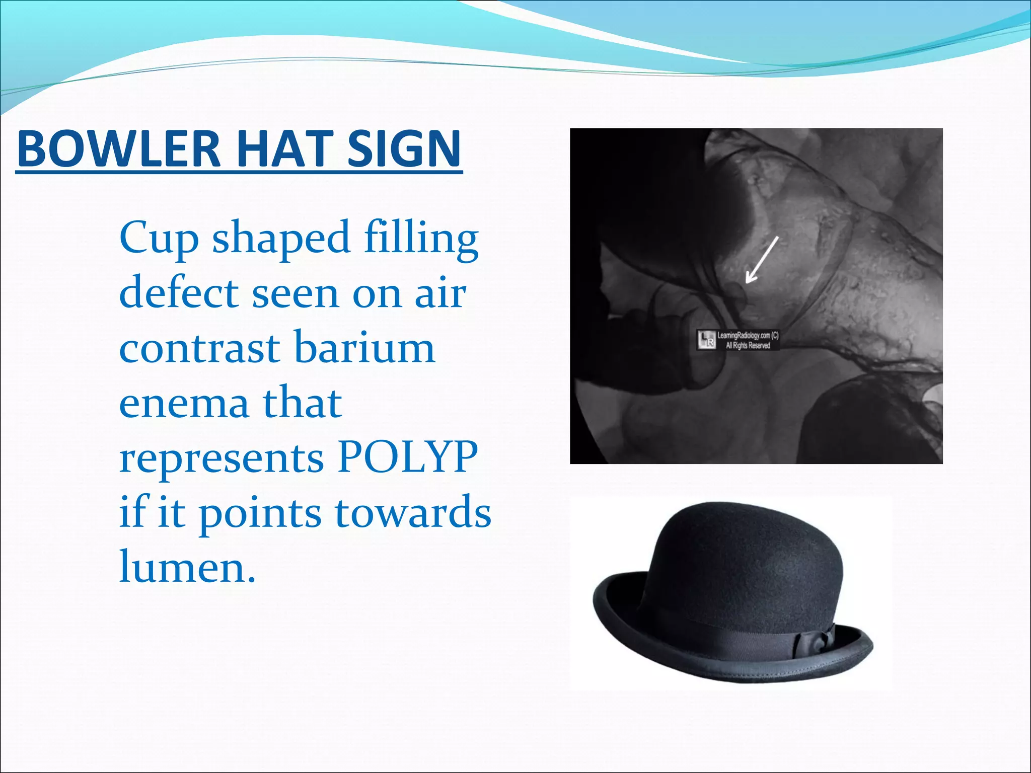 Radiology signs | PPT