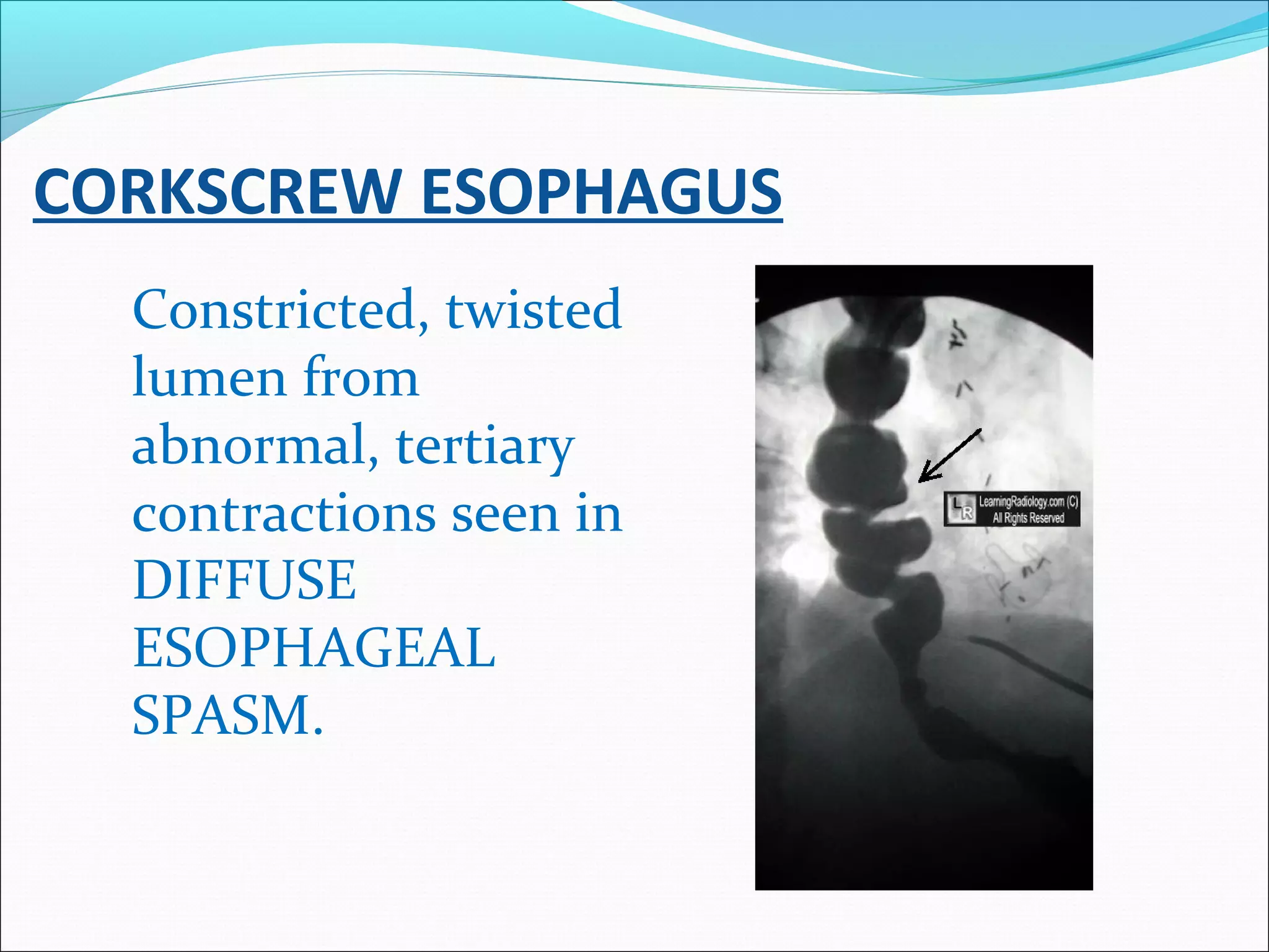 Radiology signs | PPT