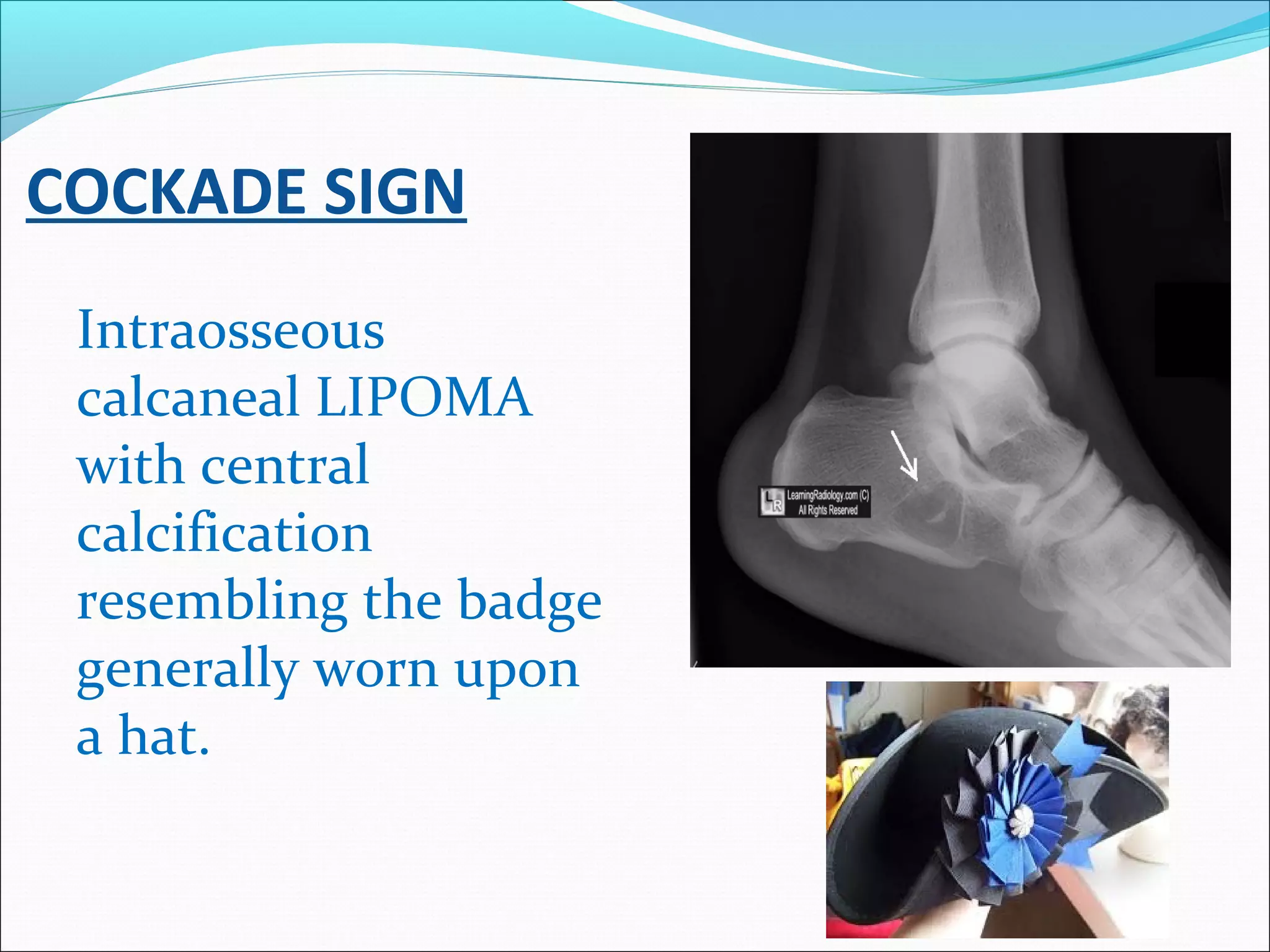 Radiology signs | PPT