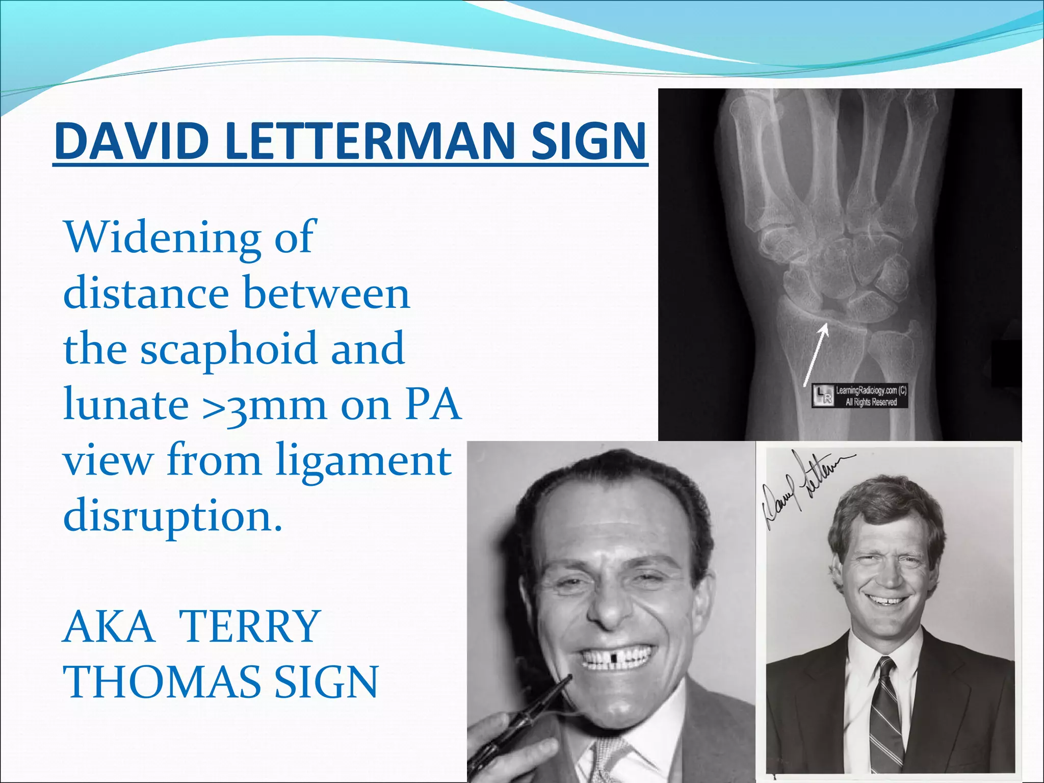 Radiology signs | PPT