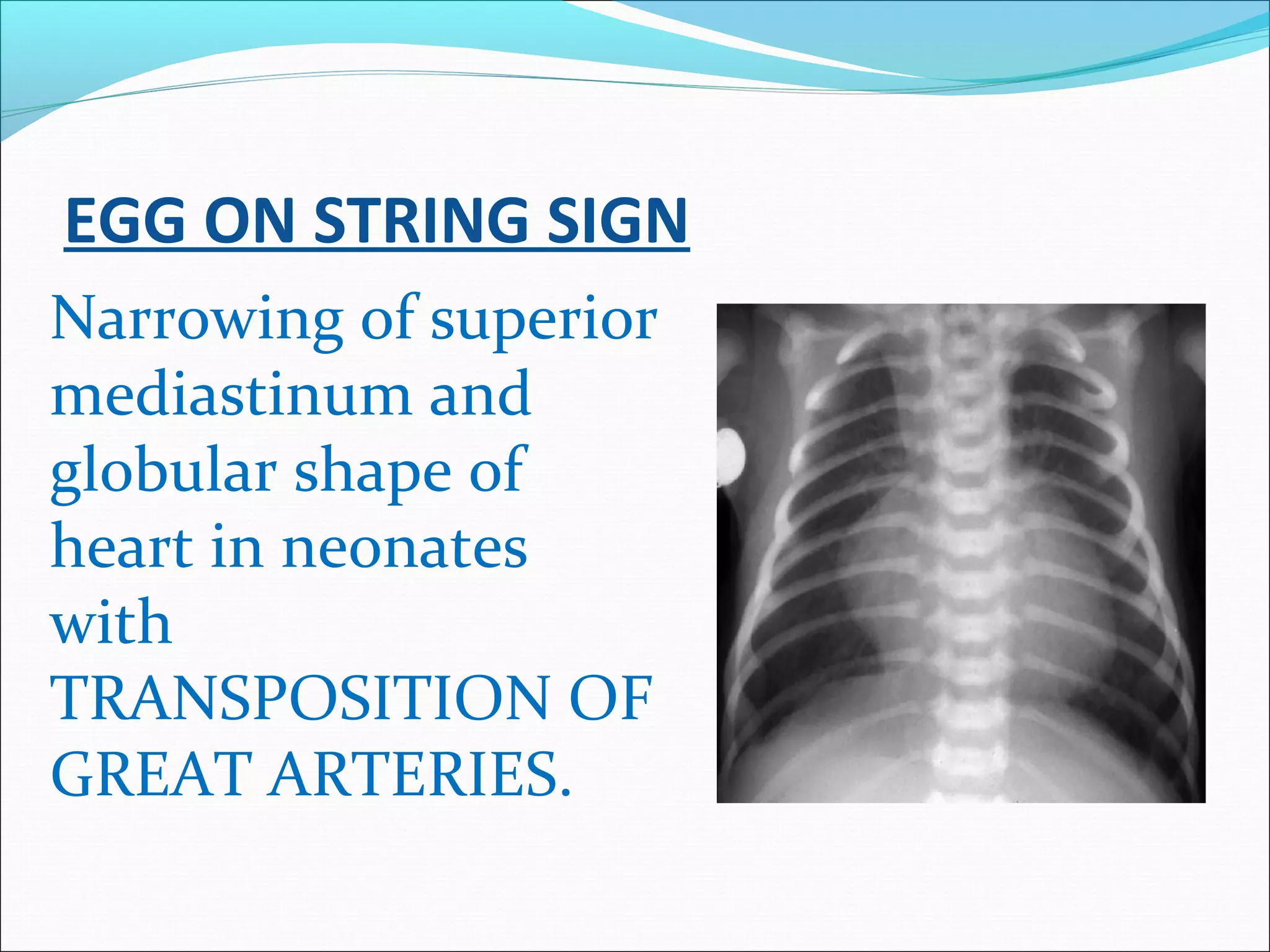 Radiology signs | PPT