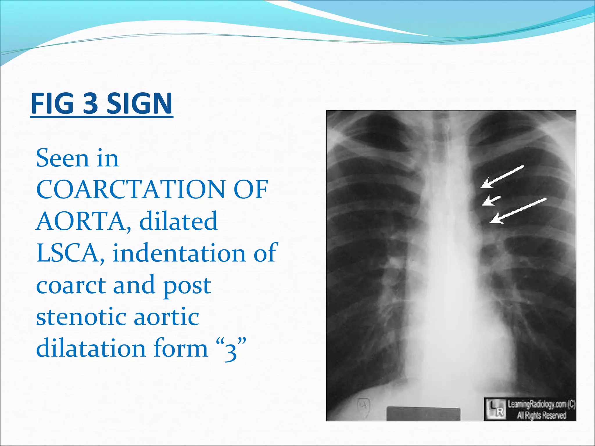 Radiology signs | PPT