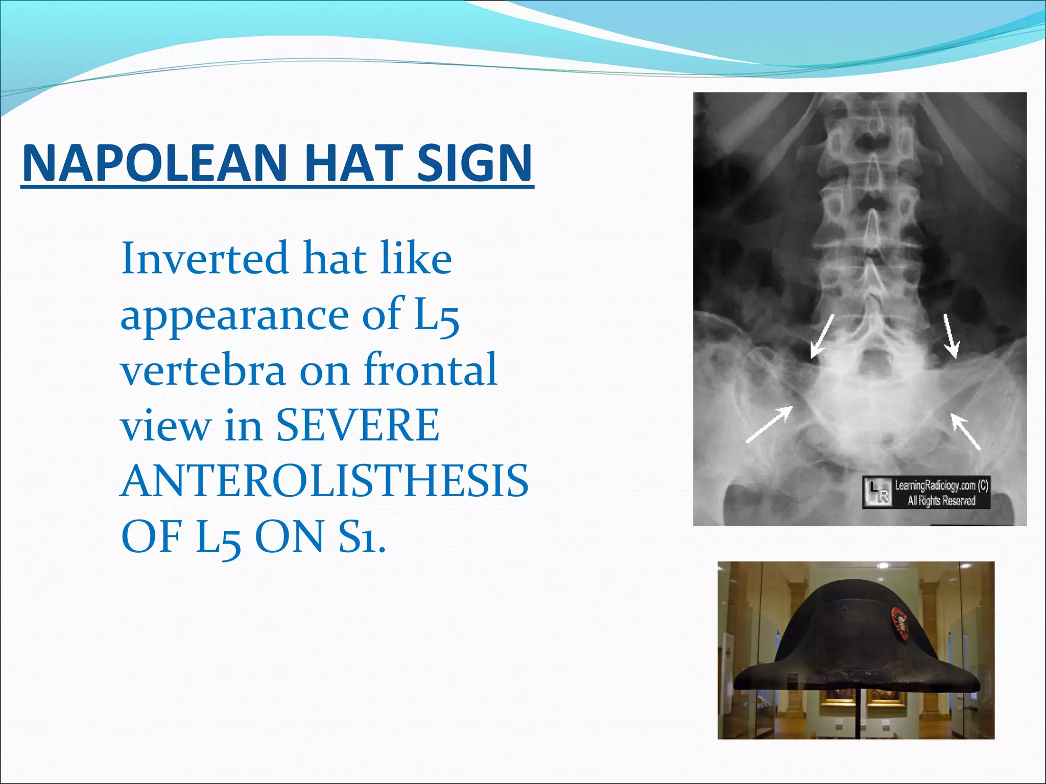 Radiology signs | PPT