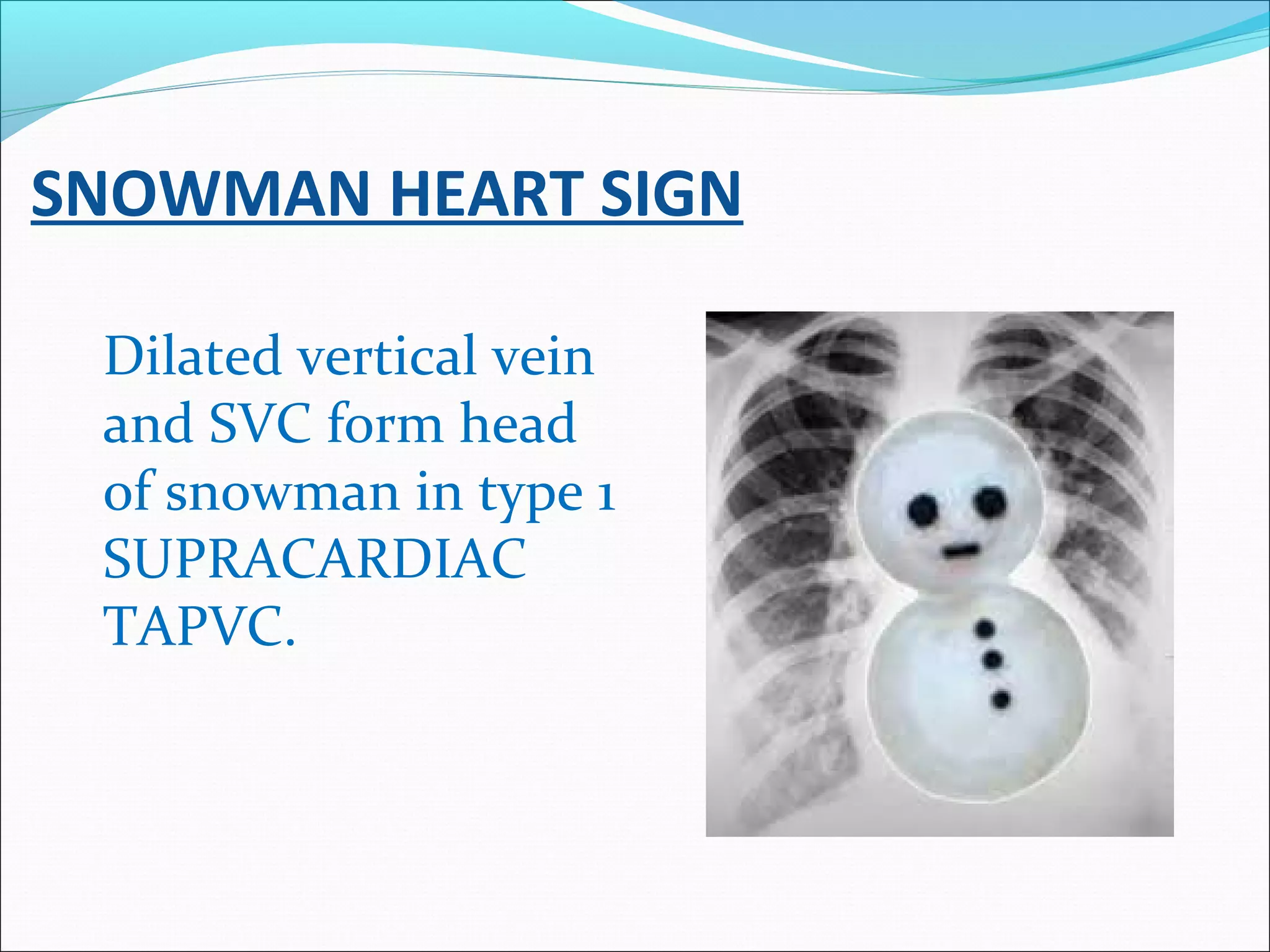 Radiology signs | PPT