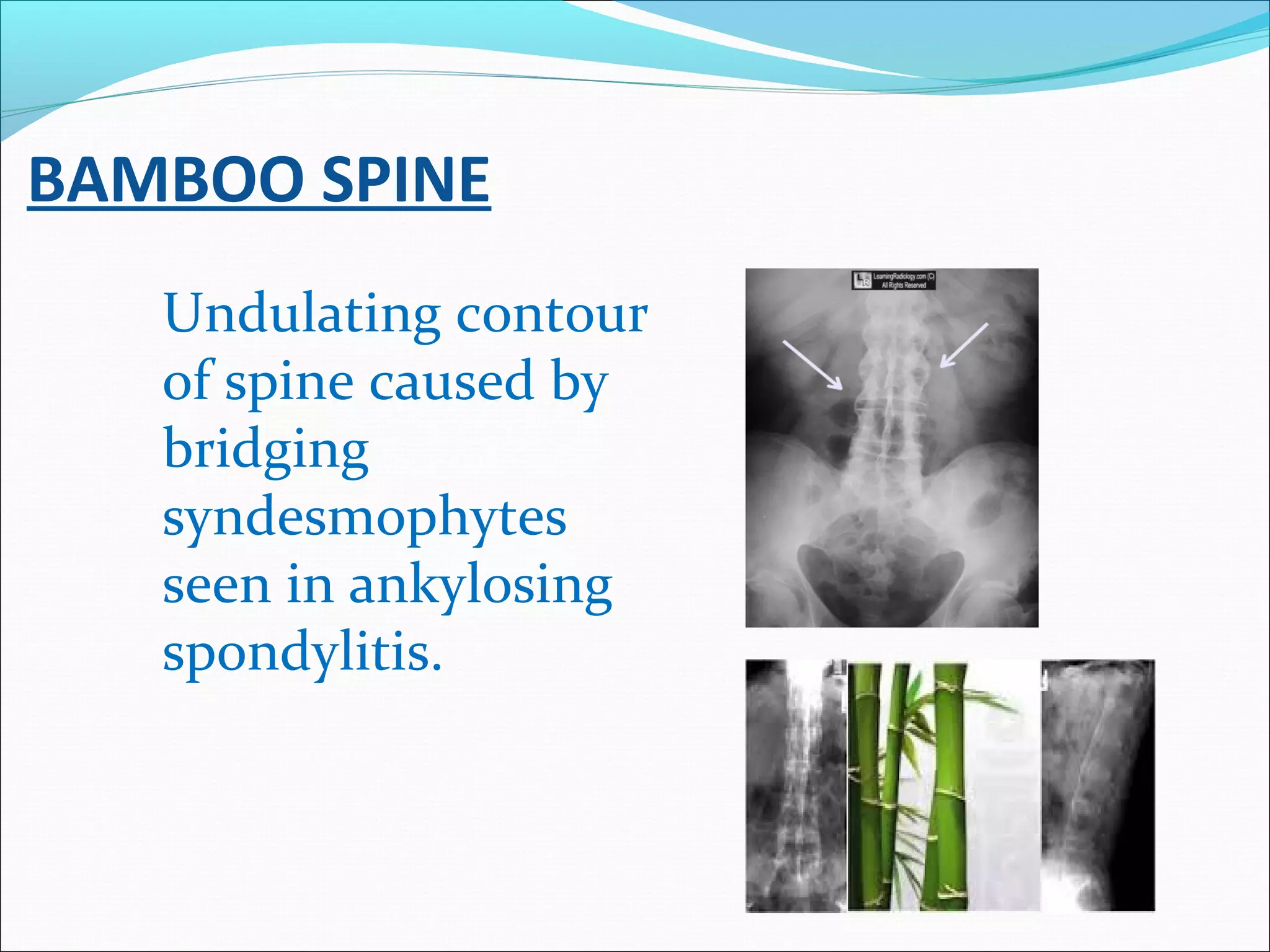 Radiology signs | PPT