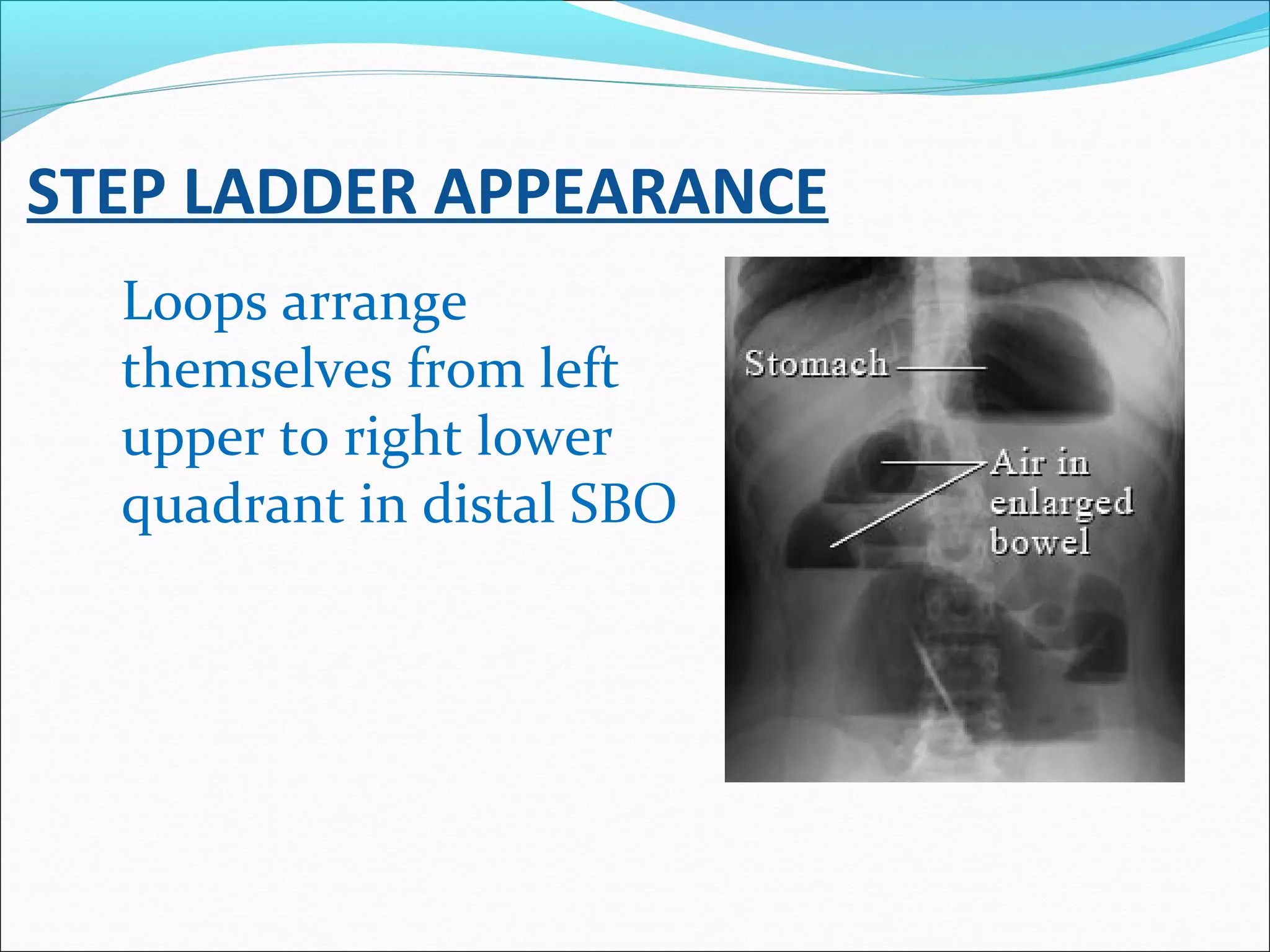 Radiology signs | PPT