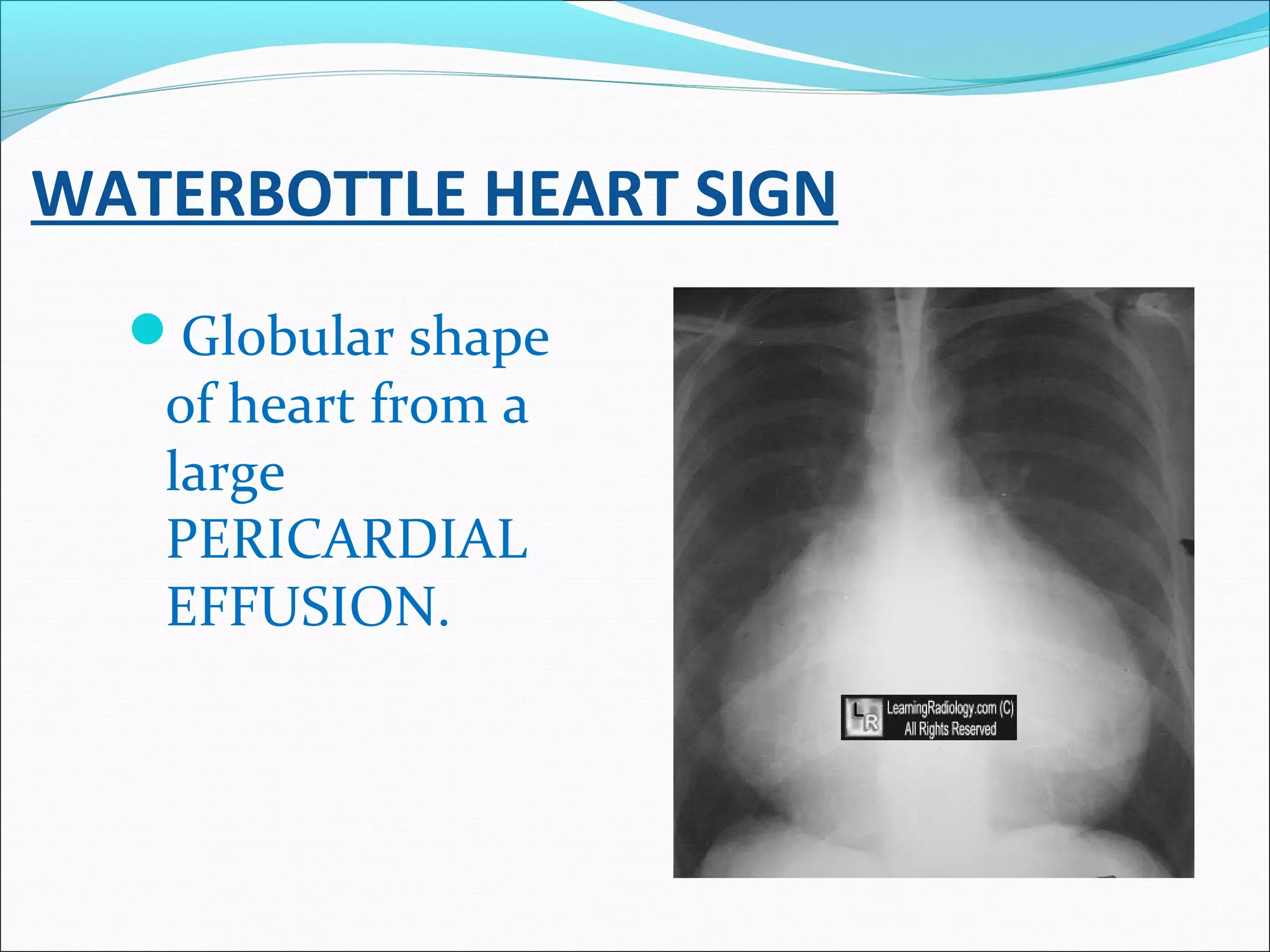 Radiology signs | PPT