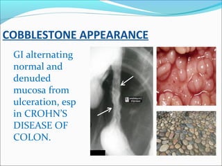 Radiology signs | PPT