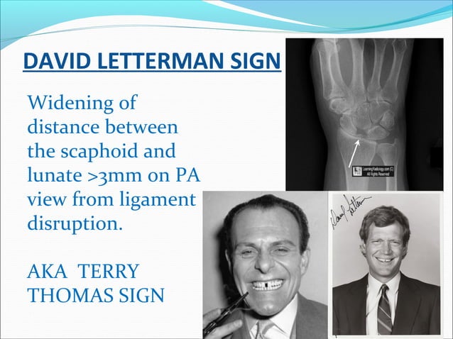 Radiology signs | PPT