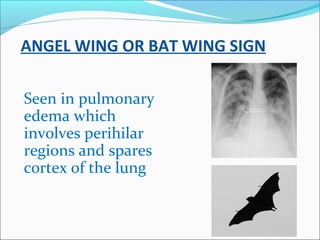 Radiology signs | PPT
