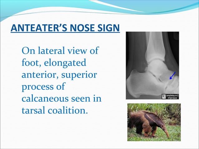 Radiology signs | PPT