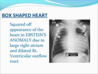 Radiology signs | PPT