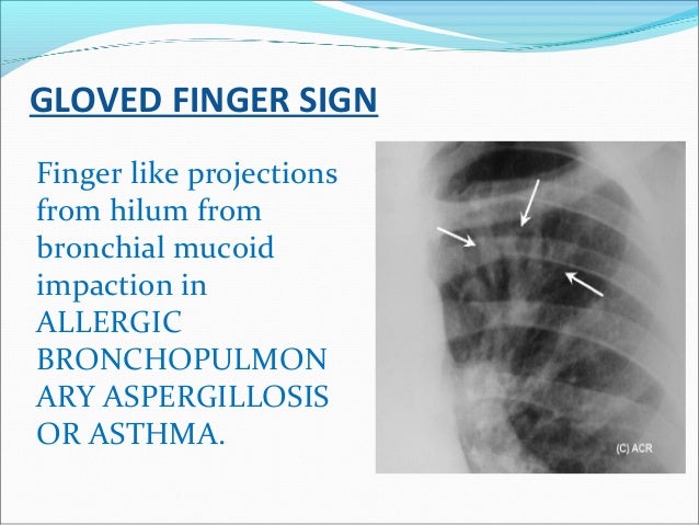 Radiology signs