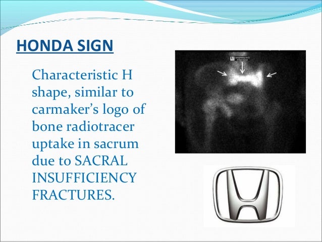Radiology signs