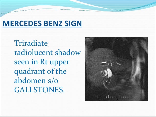 Radiology signs