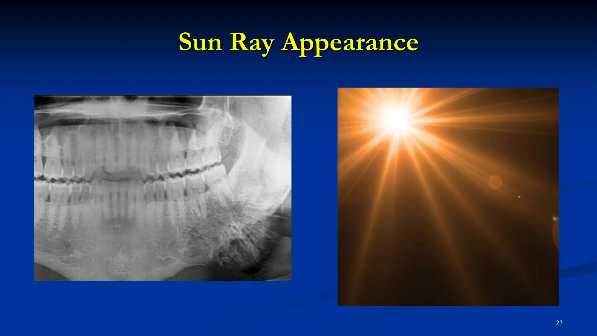 radiological terminologies oral pathology | PPTX