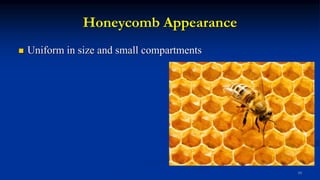 radiological terminologies oral pathology | PPTX