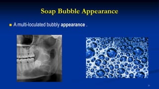 radiological terminologies oral pathology | PPTX