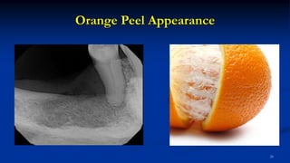 radiological terminologies oral pathology | PPTX