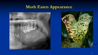 radiological terminologies oral pathology | PPTX