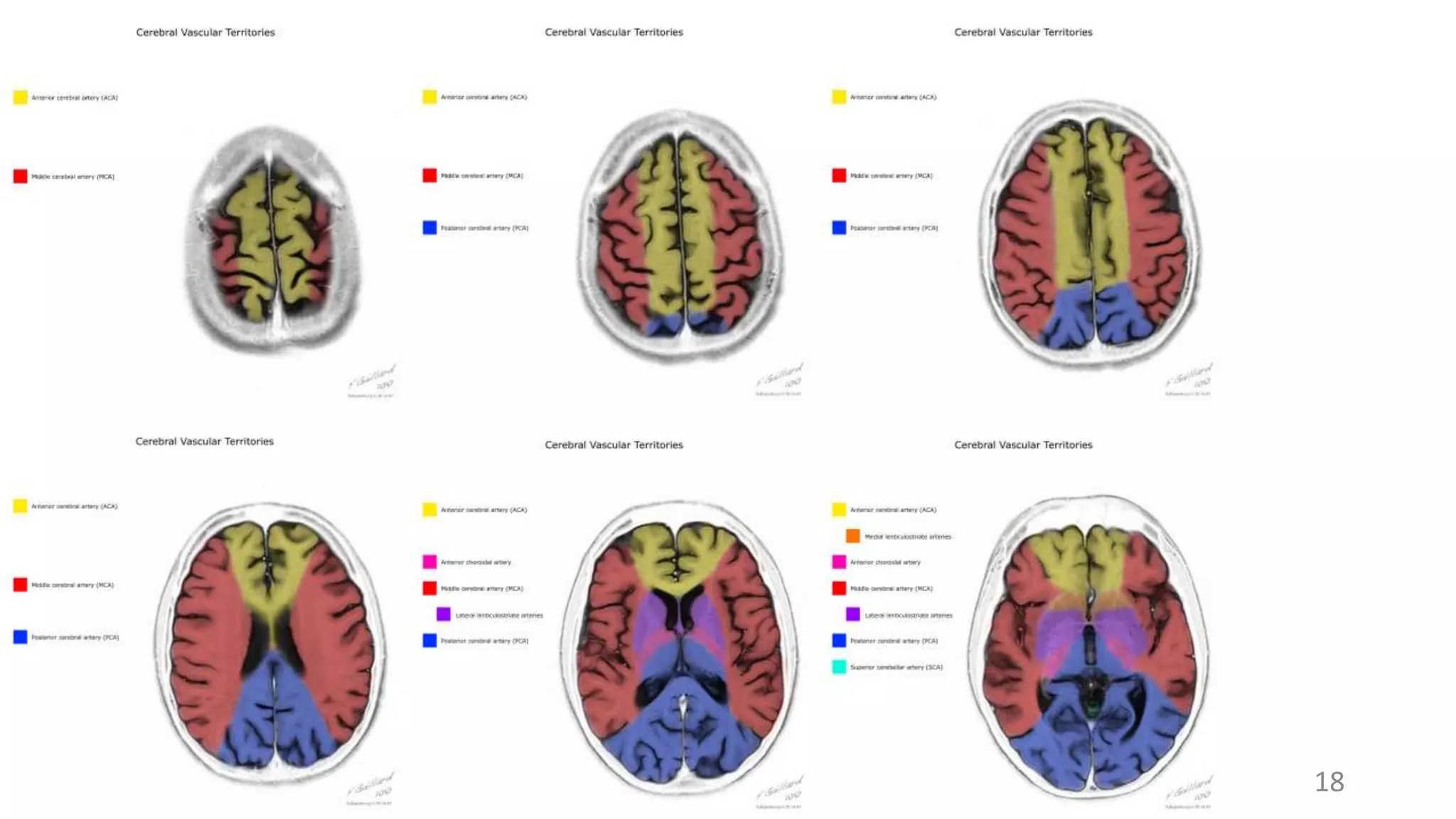 Radiologic Anatomy of the Blood Supply to the Brain.pptx