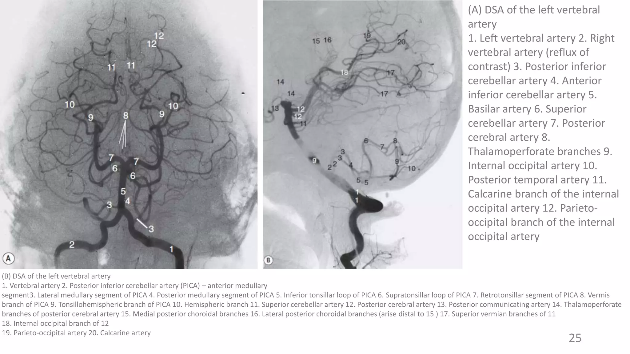 Radiologic Anatomy of the Blood Supply to the Brain.pptx