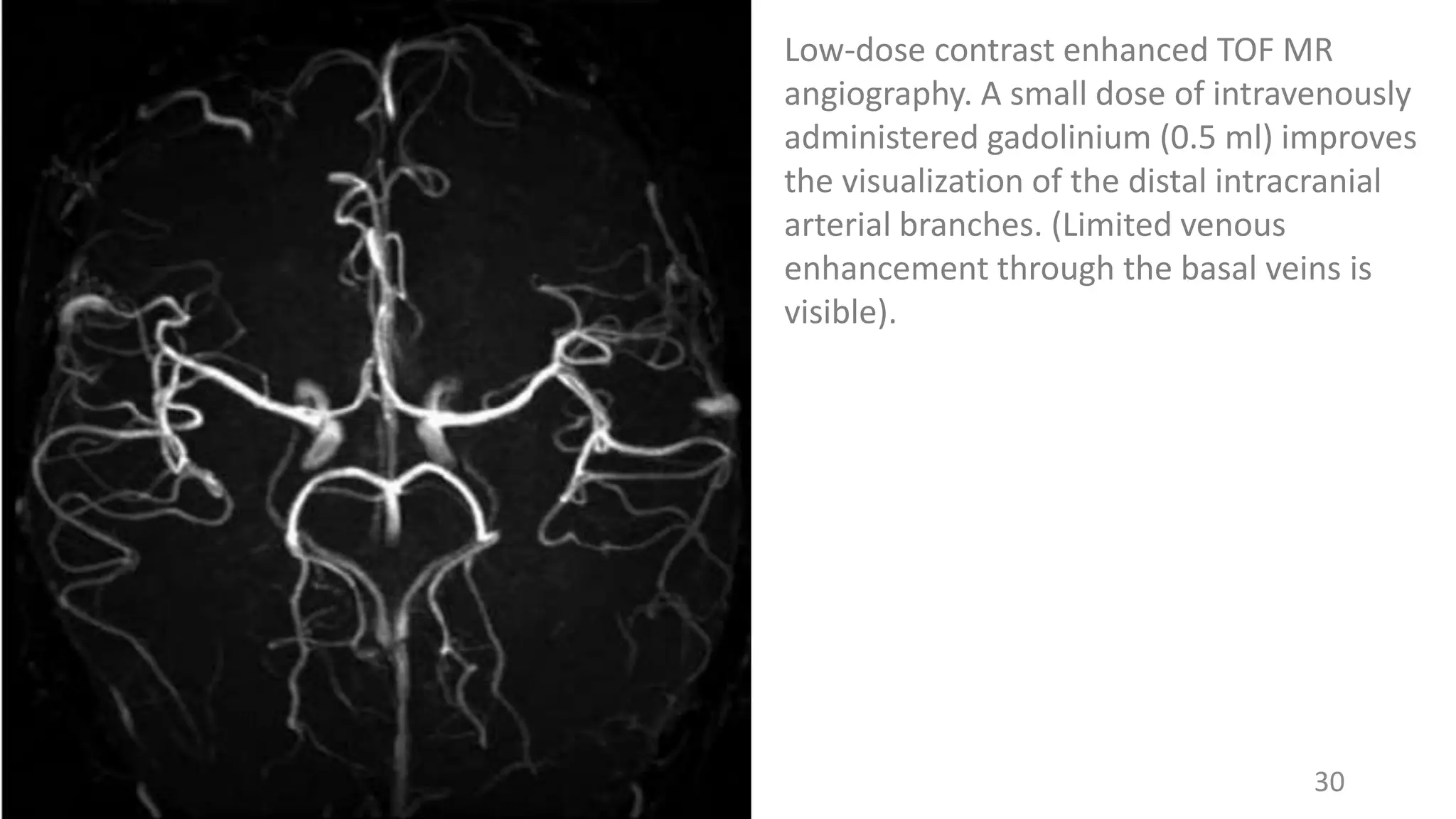 Radiologic Anatomy of the Blood Supply to the Brain.pptx