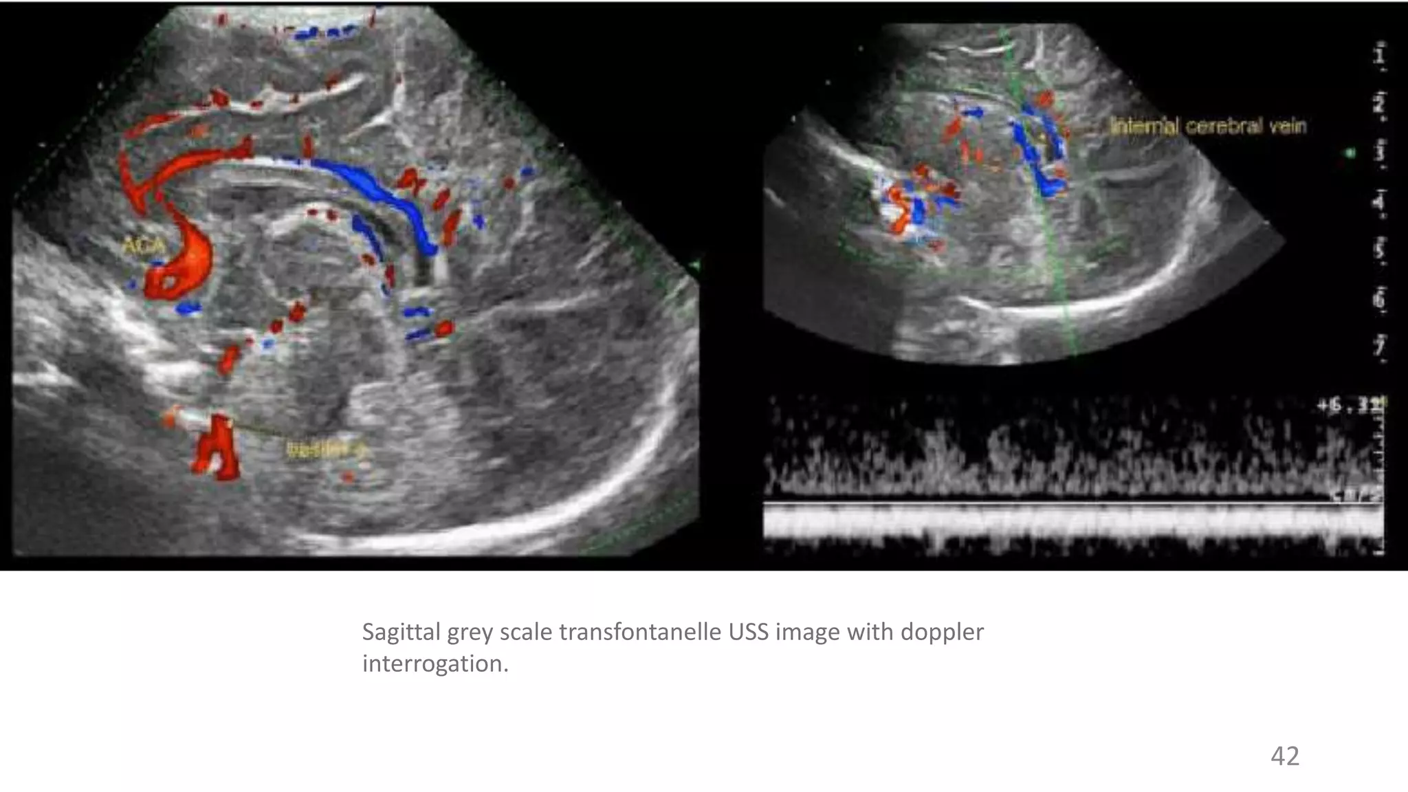 Radiologic Anatomy of the Blood Supply to the Brain.pptx