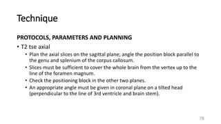 Radiologic Anatomy of the Blood Supply to the Brain.pptx