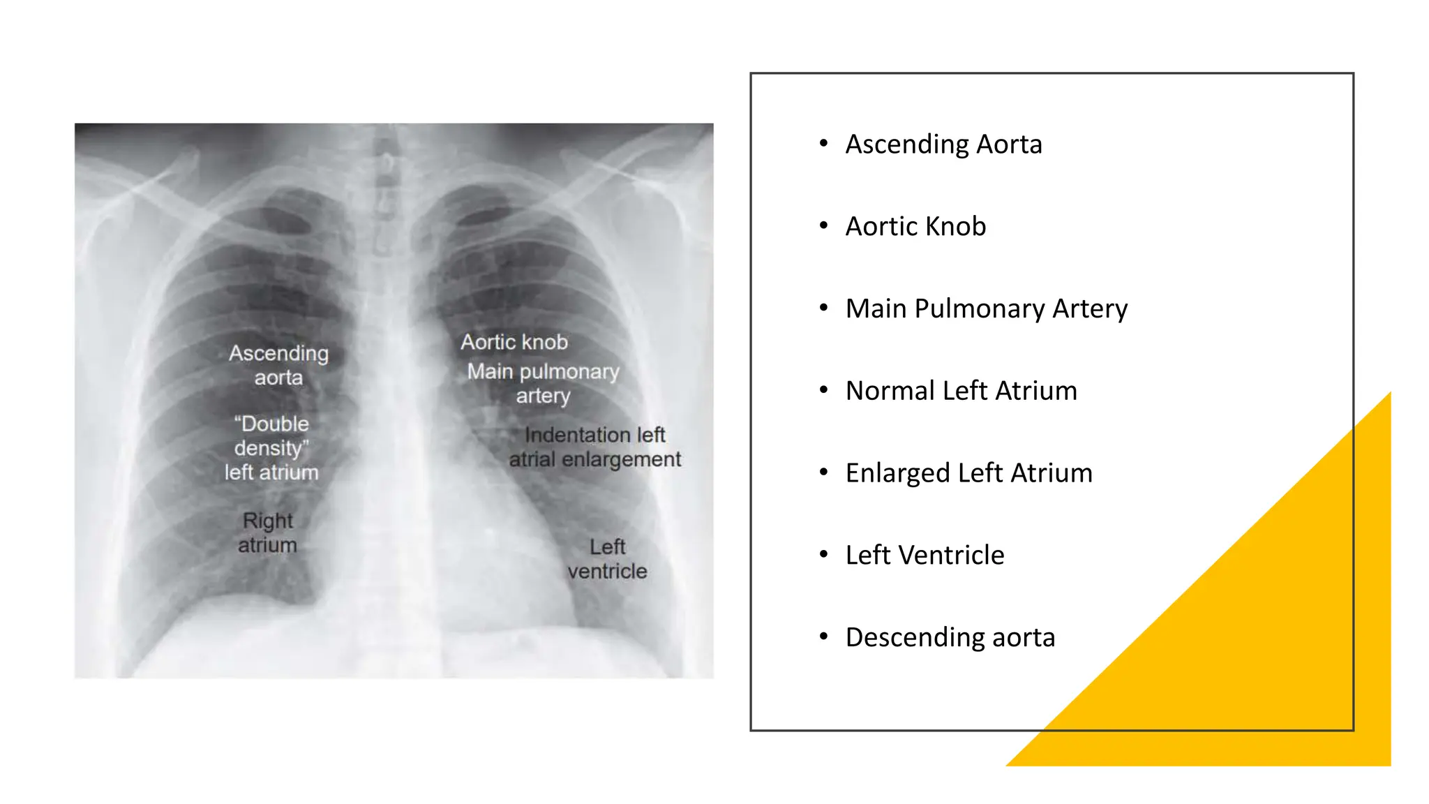 RADIOLOGIC PULMONARY ANATOMY STUDIES.PPT