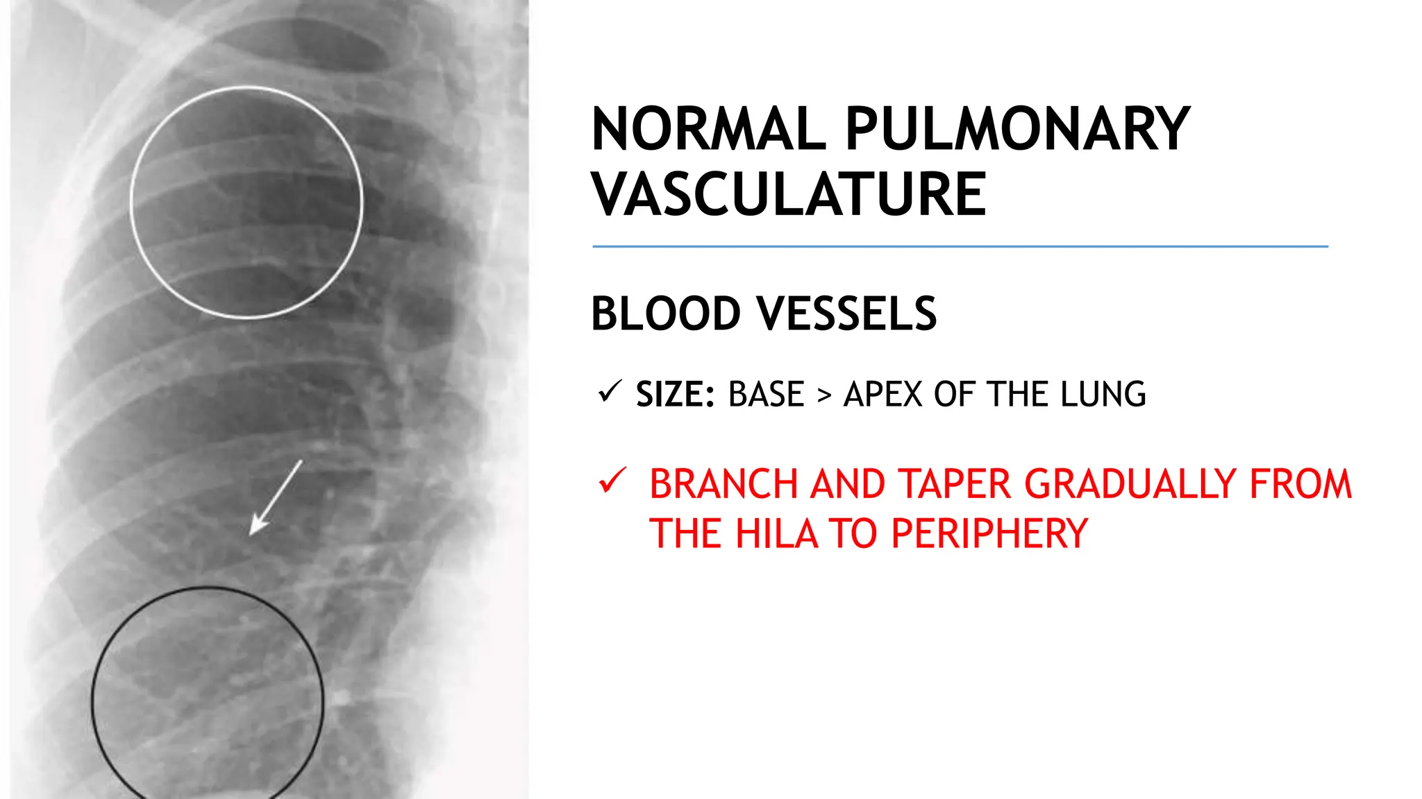RADIOLOGIC PULMONARY ANATOMY STUDIES.PPT