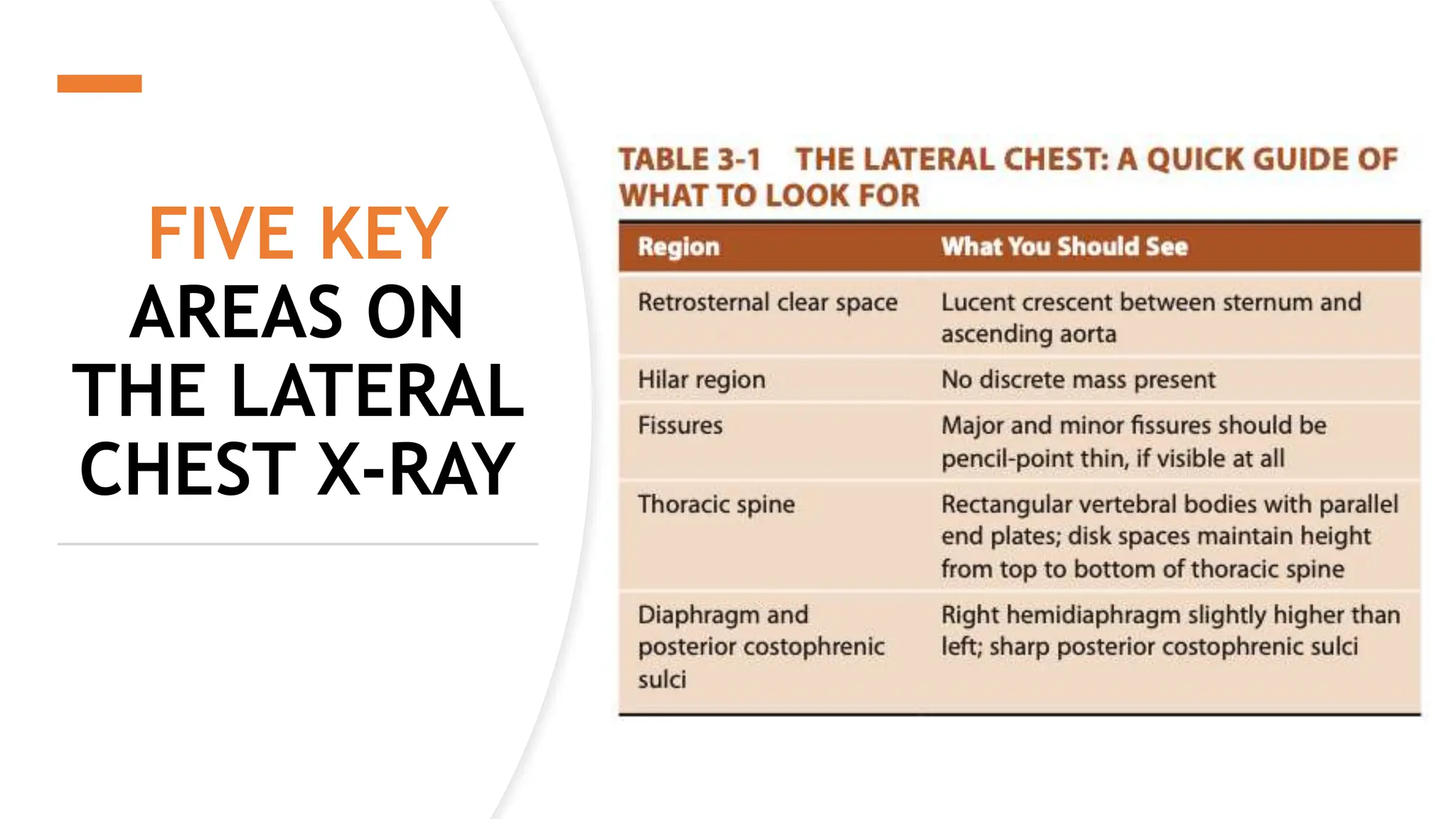 RADIOLOGIC PULMONARY ANATOMY STUDIES.PPT