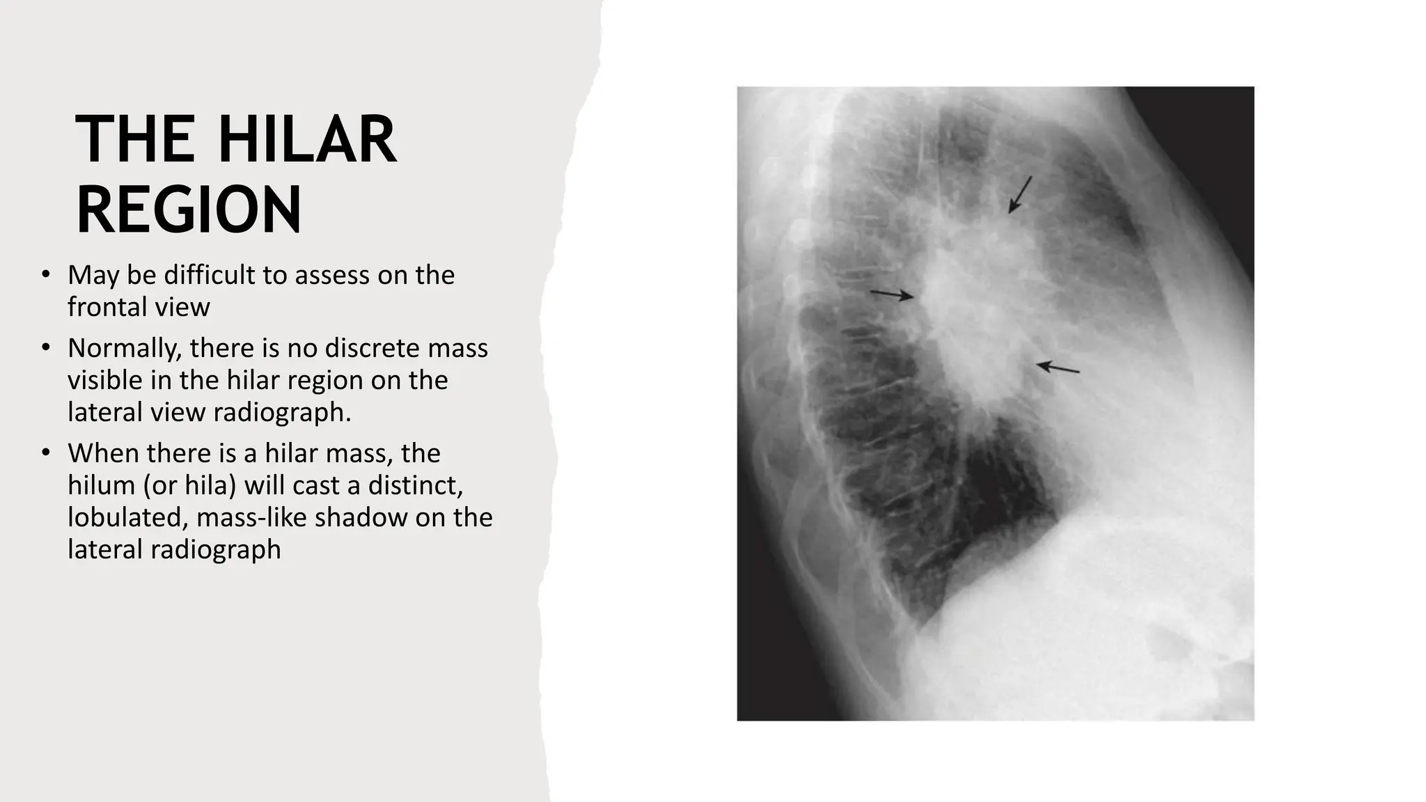 RADIOLOGIC PULMONARY ANATOMY STUDIES.PPT