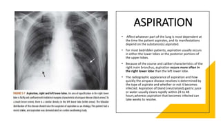 RADIOLOGIC PULMONARY ANATOMY STUDIES.PPT