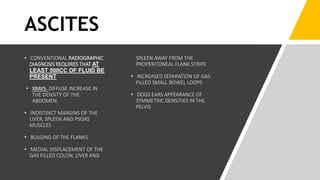 RADIOLOGIC PULMONARY ANATOMY STUDIES.PPT