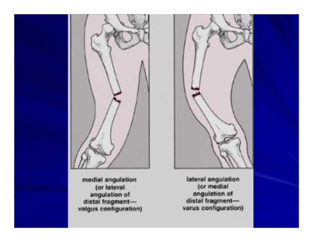Tulang | PPT