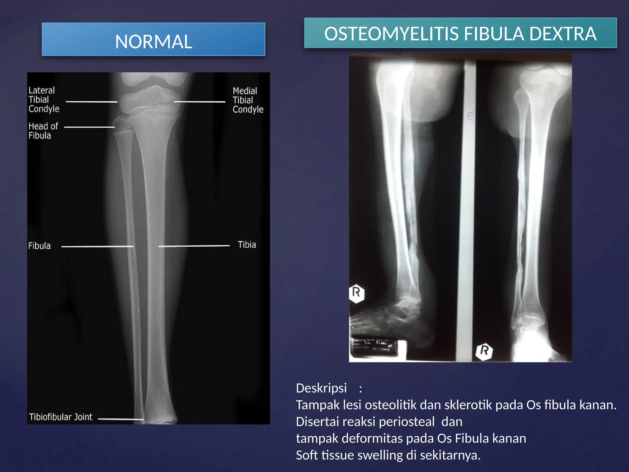 Radiologi Xray for Medicine Phisioterapy.pptx