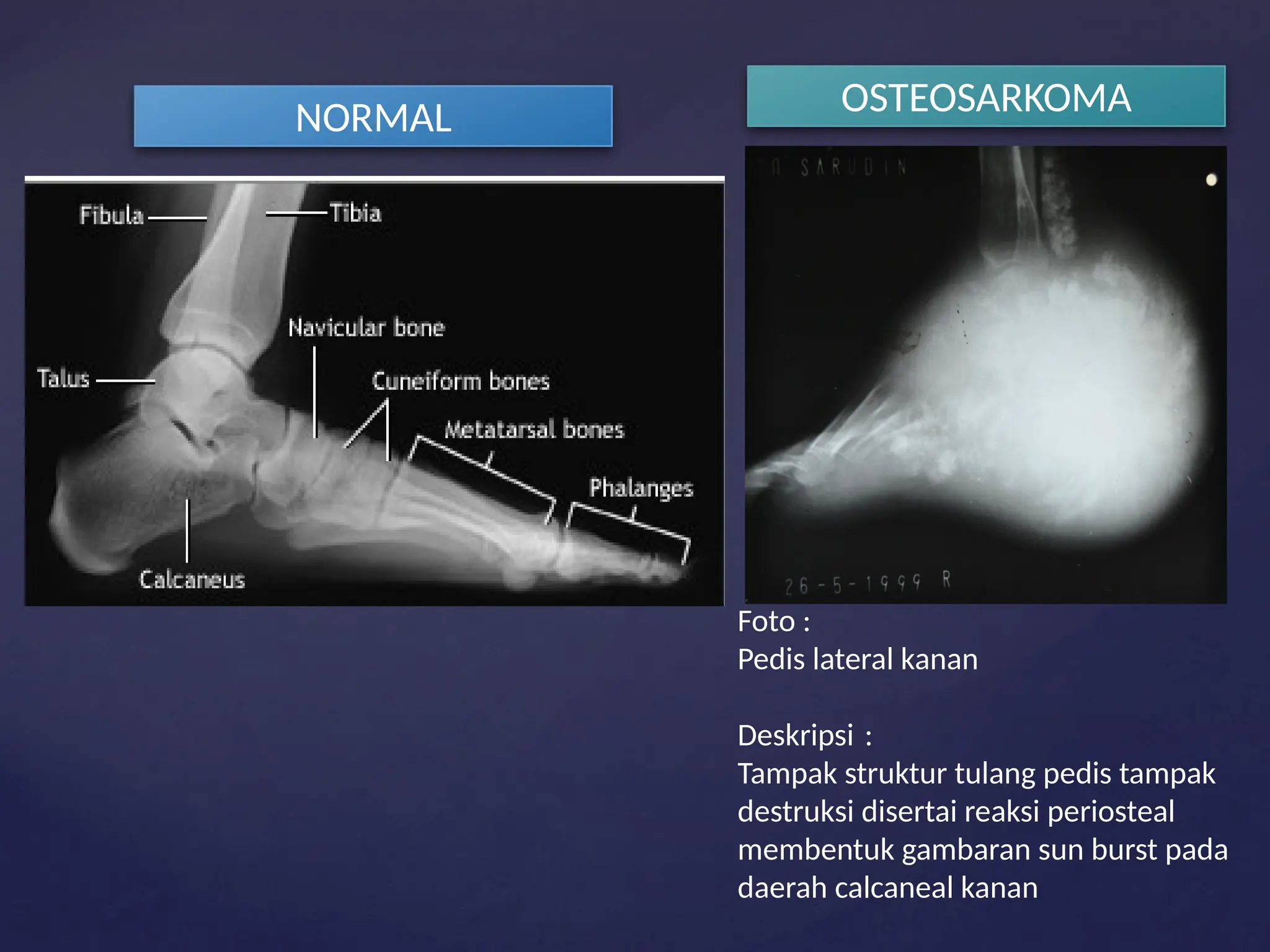 Radiologi Xray for Medicine Phisioterapy.pptx