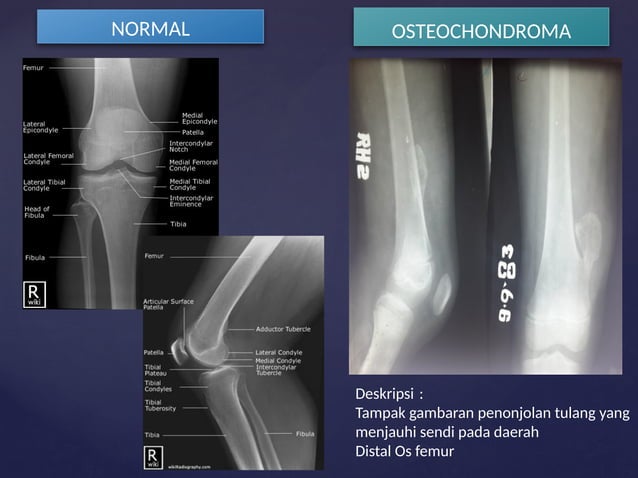 Radiologi Xray for Medicine Phisioterapy.pptx