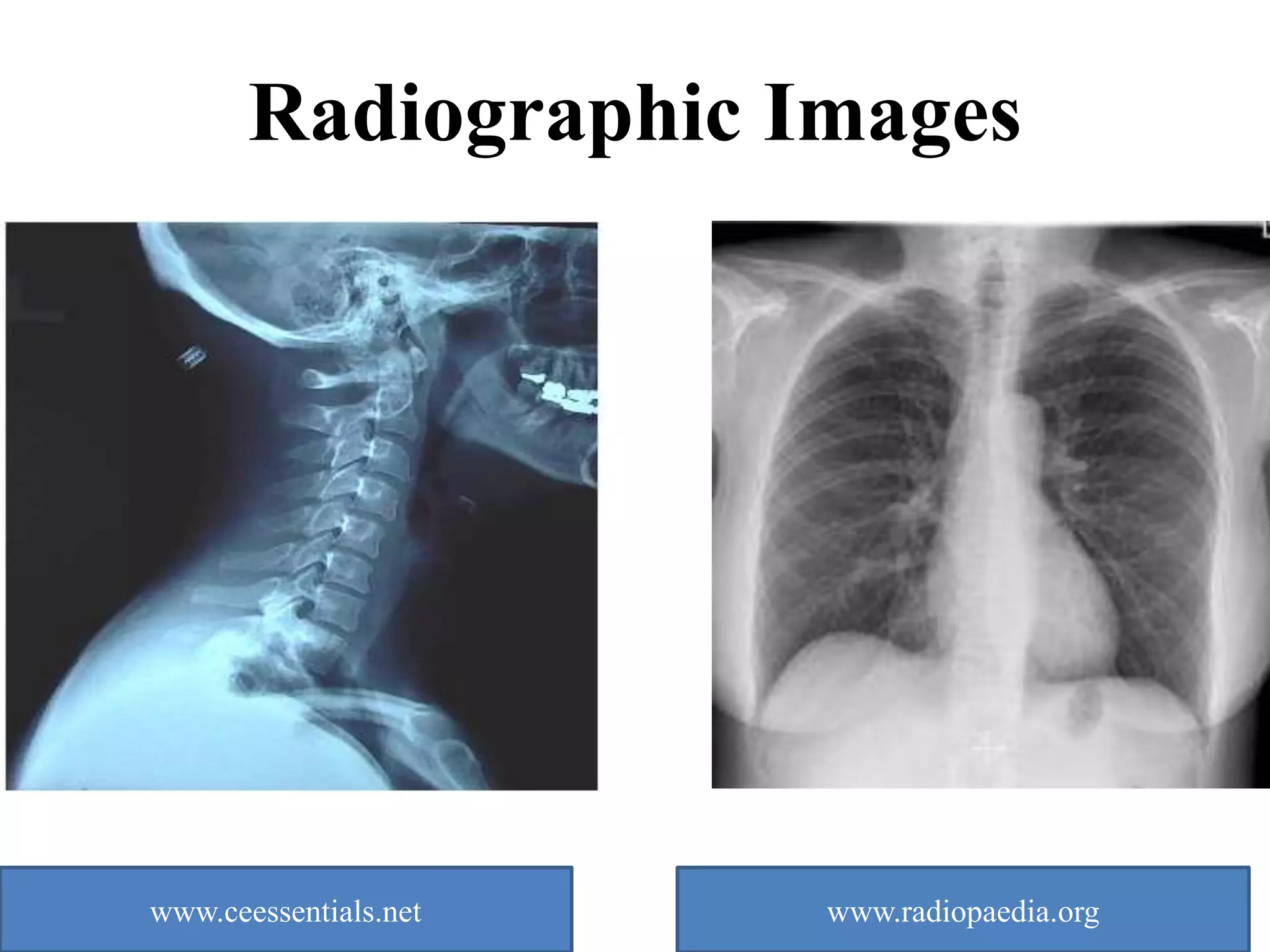 Radiology | PPTX