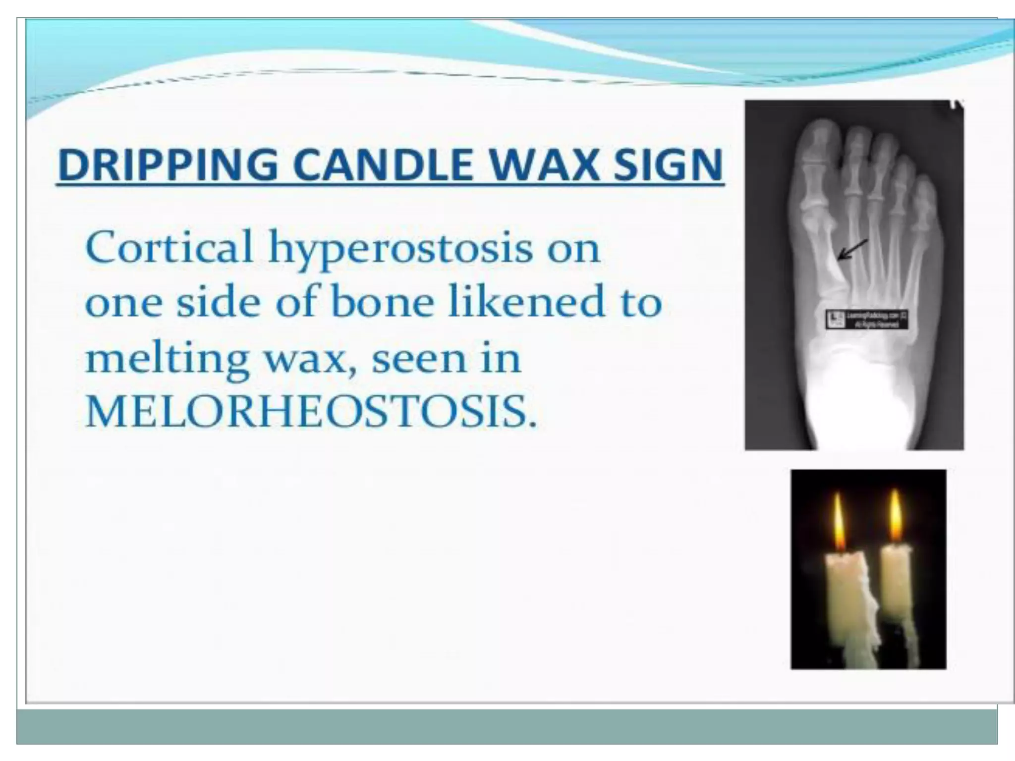 Radiology signs and symptoms | PDF