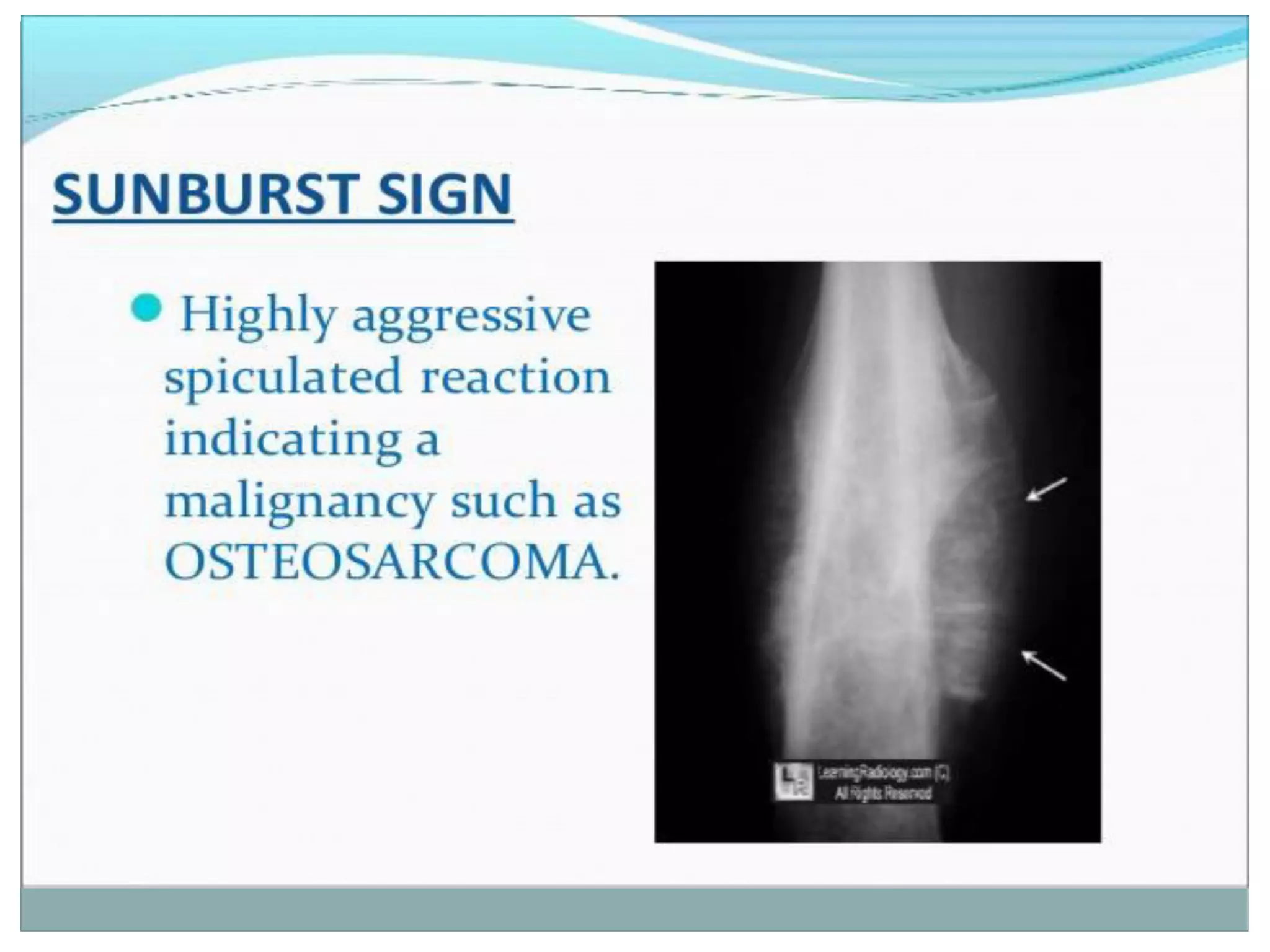 Radiology signs and symptoms | PDF
