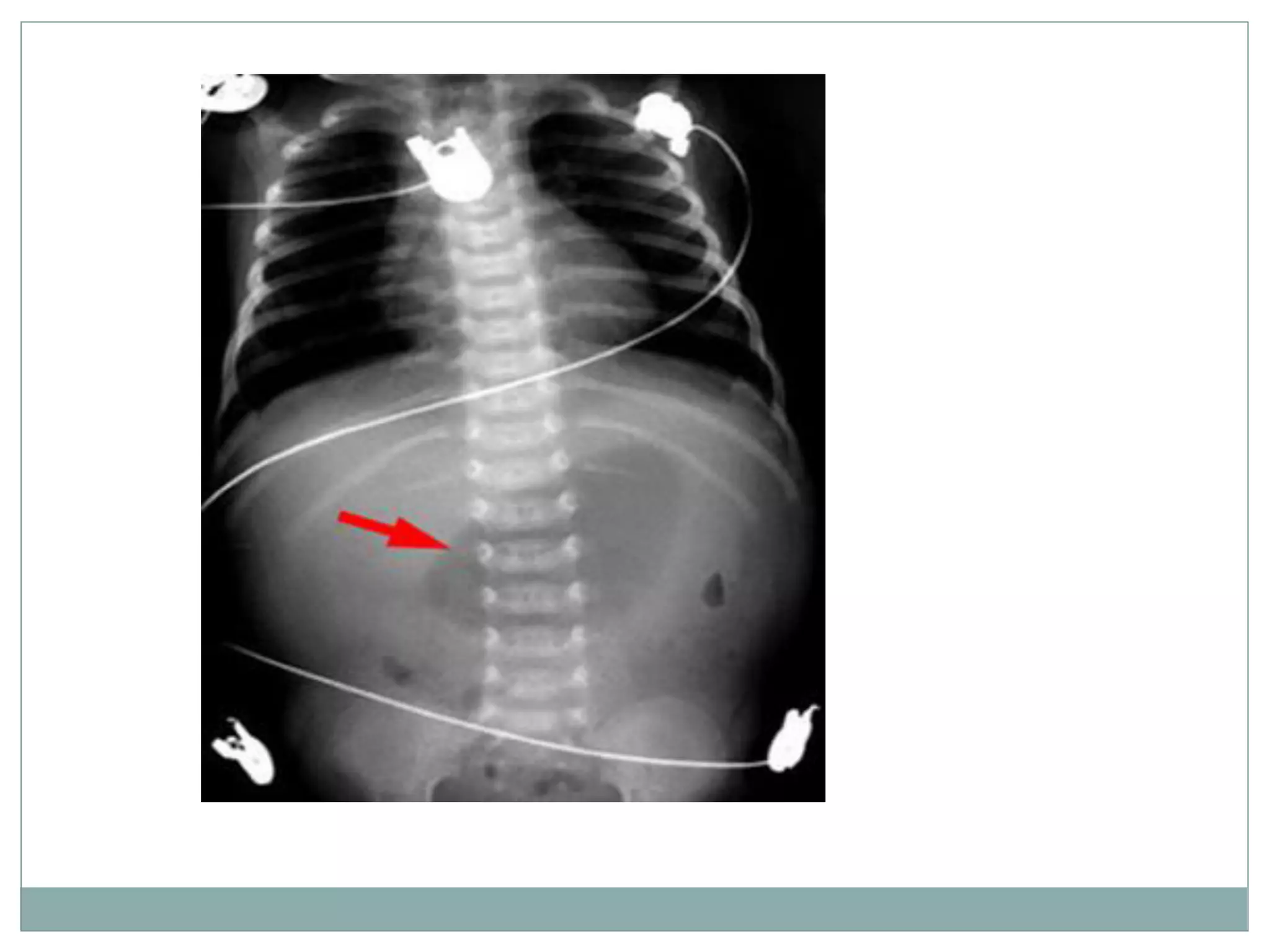 Radiology signs and symptoms | PDF